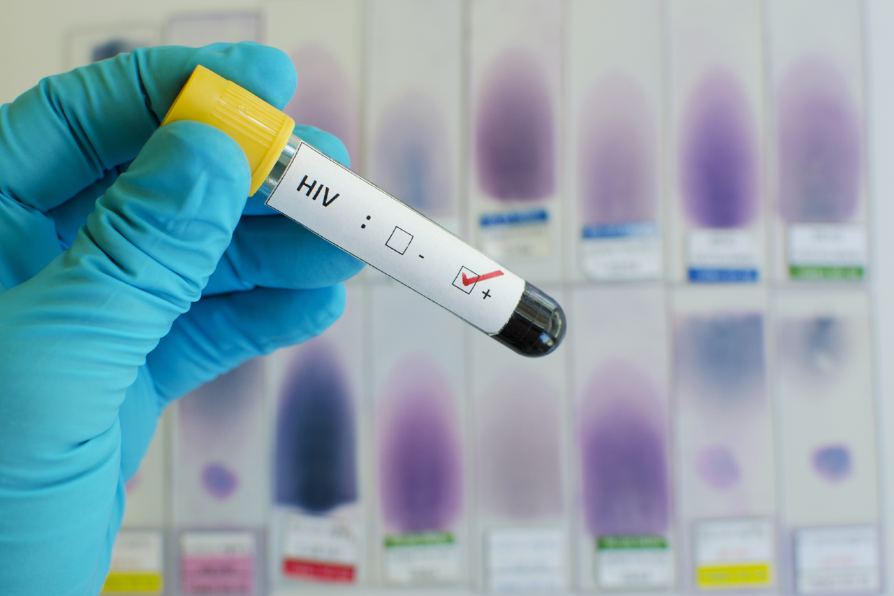 HPV and HIV: Know the Difference